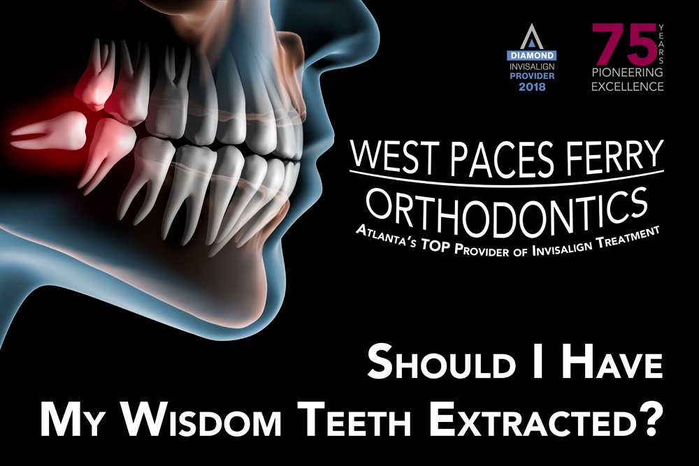 Should I Have My Wisdom Teeth Extracted? – West Paces Ferry Orthodontics